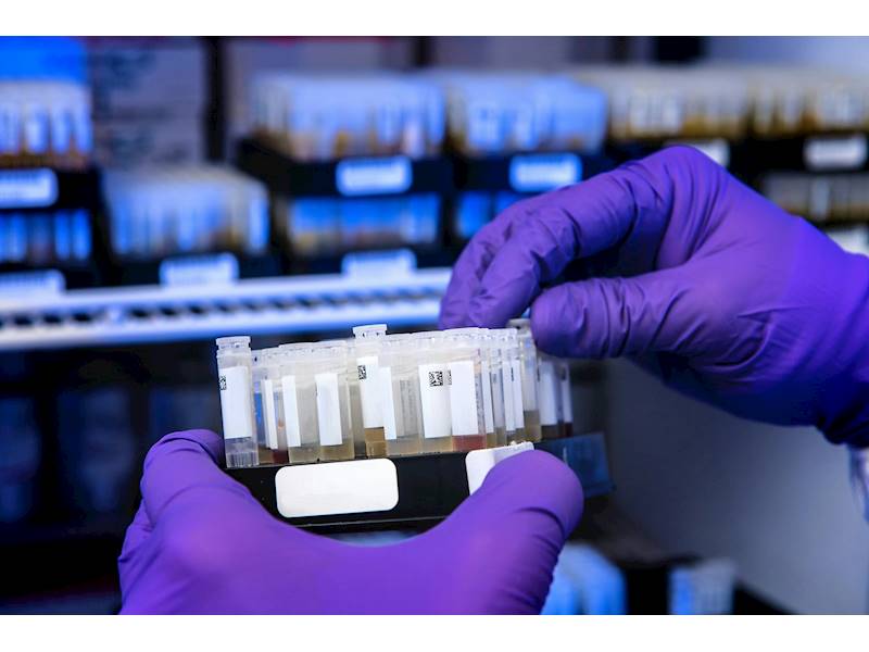Top Tier Human Specimen Biobank for sale in New York City